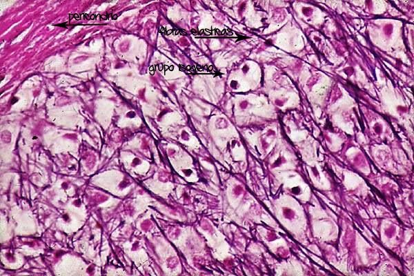 HISTOLOGIA: catilago elastico y fibrocartilago